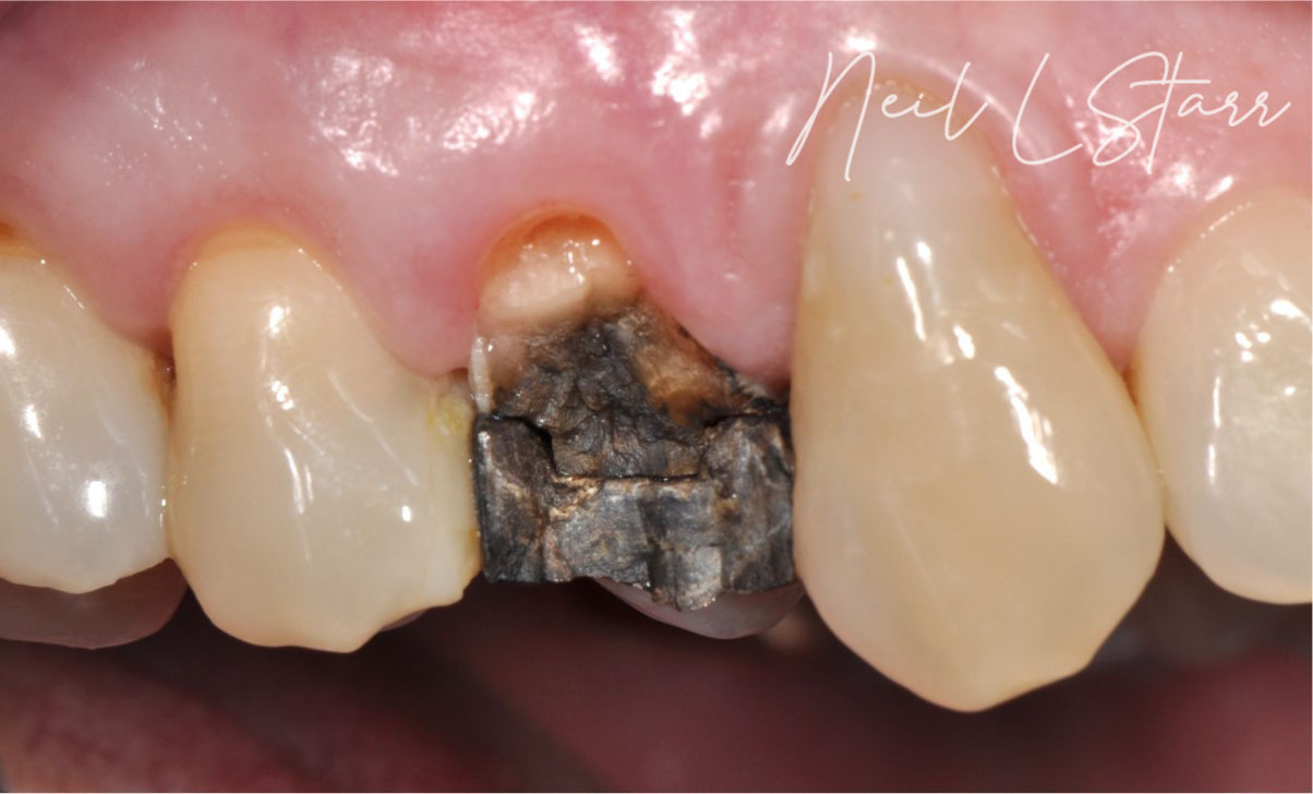 Smile gallery - Starr Teeth