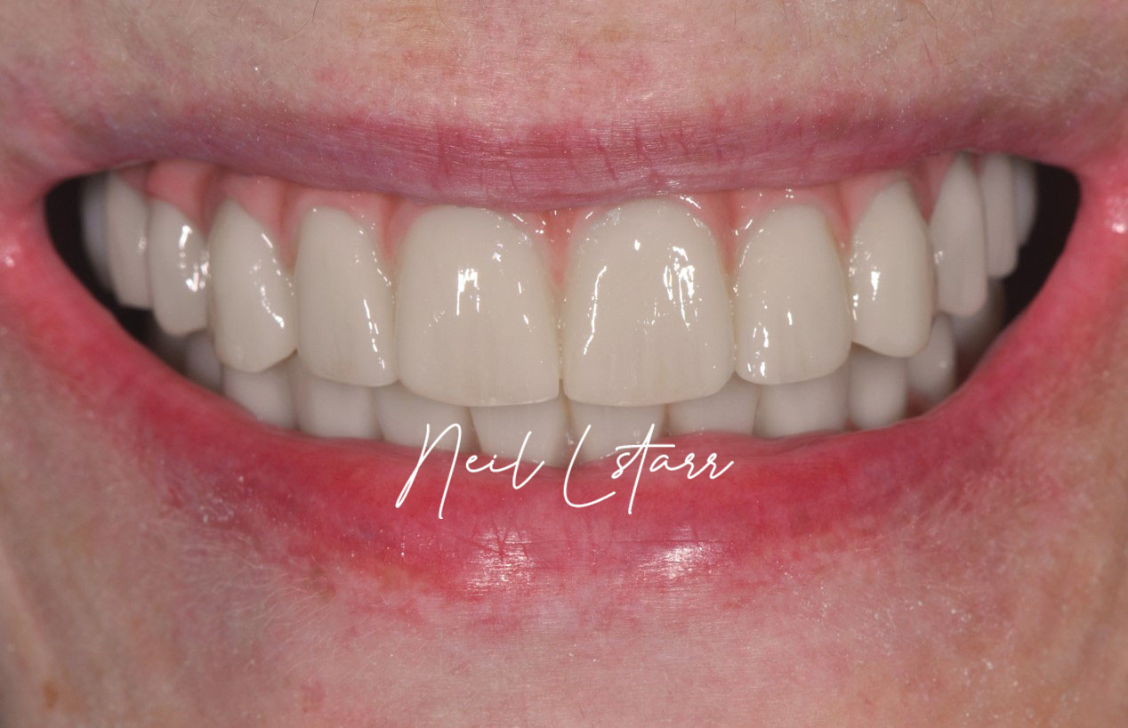 Smile gallery - Starr Teeth