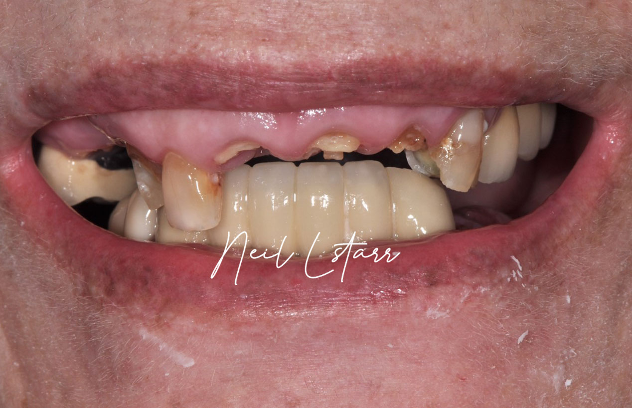 Smile gallery - Starr Teeth